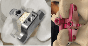 2024 Spine Coding Changes for ASCs: Your Questions Answered! | nimble ...