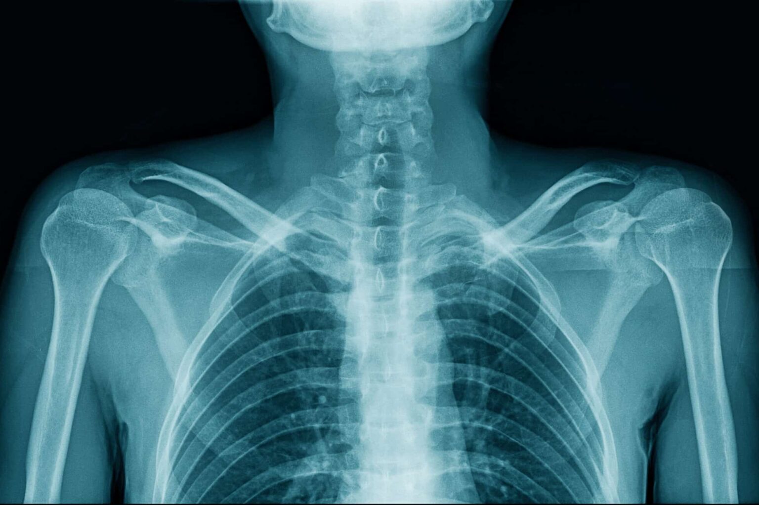2025 - Shoulder Procedures | nimble solutions