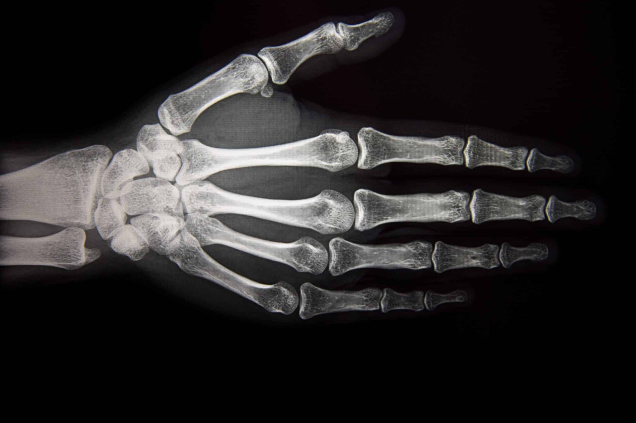 2025 - Wrist, Hand, and Fingers | nimble solutions